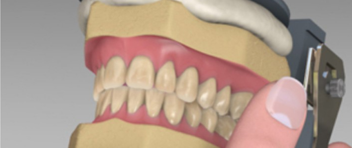 Denture Teeth